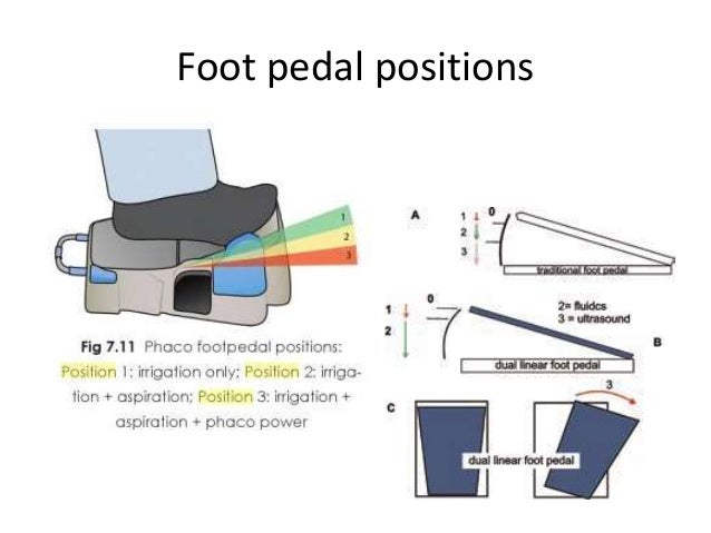 Phacodynamics basics!