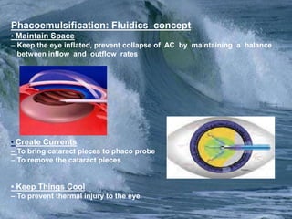 PHACODYNAMICS IN OPHTHALMOLOGY FOR BEGINNERS | PPT