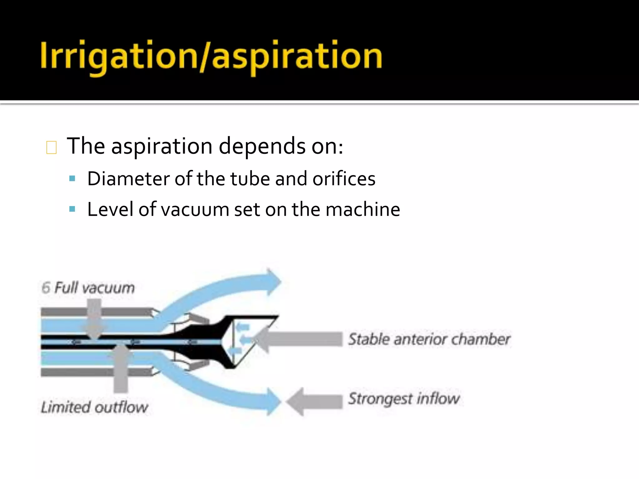 Phacoemulsification | PPTX