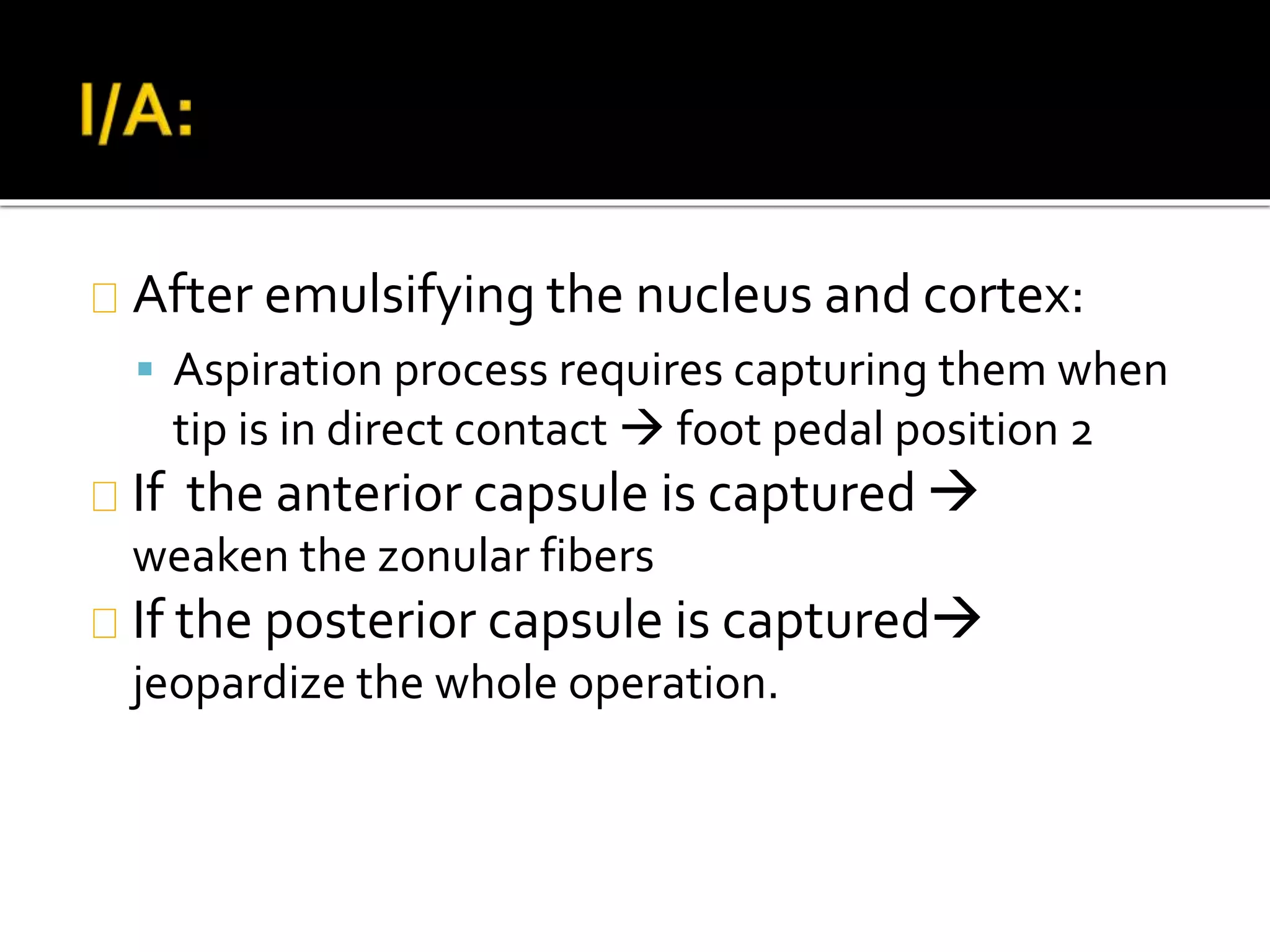Phacoemulsification | PPTX