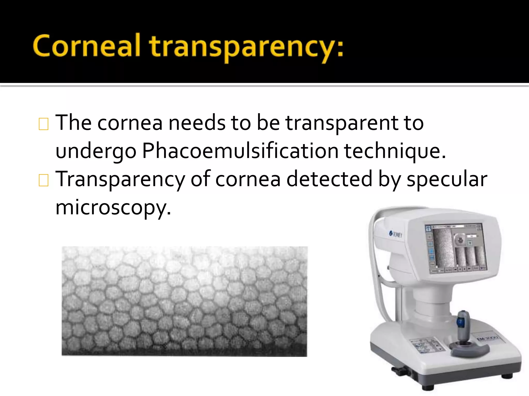 Phacoemulsification | PPTX