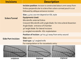 Phacoemulsification | PPTX
