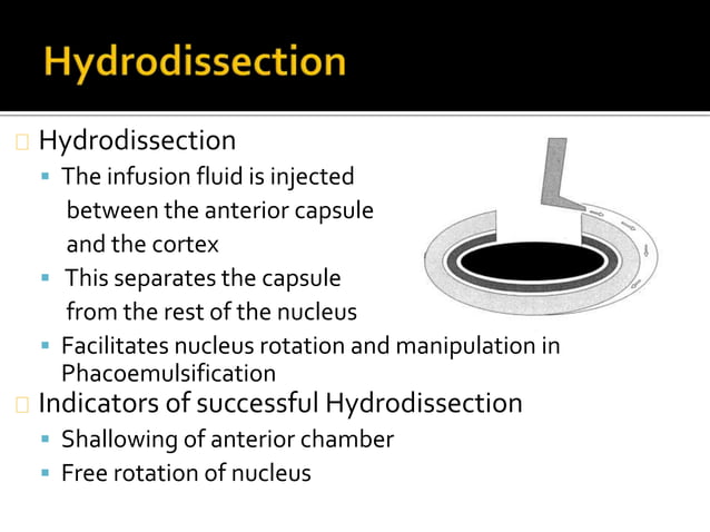 Phacoemulsification | PPTX | Eye and Vision Conditions | Diseases and ...