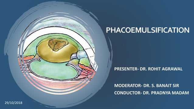 Phacoemulsification | PPTX | Eye and Vision Conditions | Diseases and Conditions