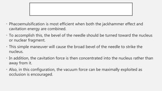 Phacoemulsification part 1 | PPTX