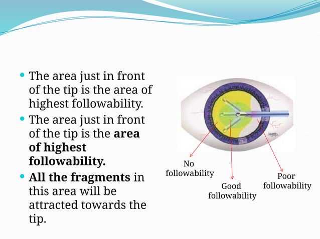 PHACOEMULSIFICATION in Ophthalmology.pptx