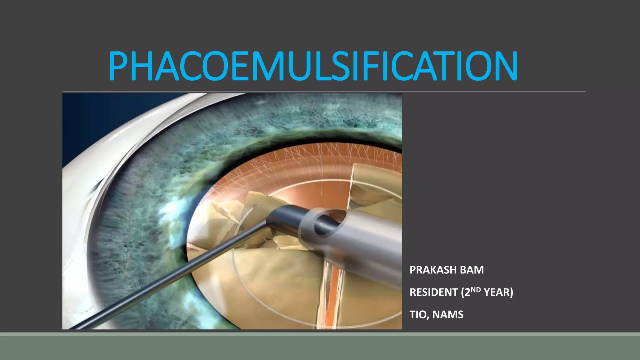 Phacoemulsification Prakash Bam.pptx | Eye and Vision Conditions | Diseases and Conditions