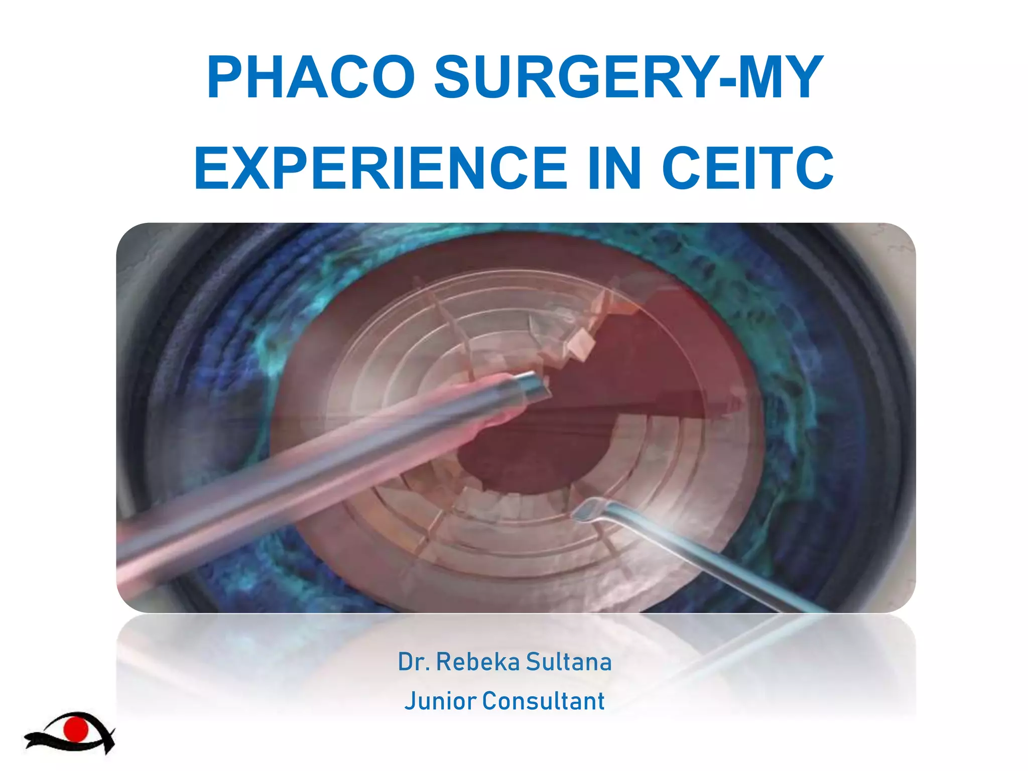 PHACO EXPERIENCE | PPTX | Eye and Vision Conditions | Diseases and Conditions