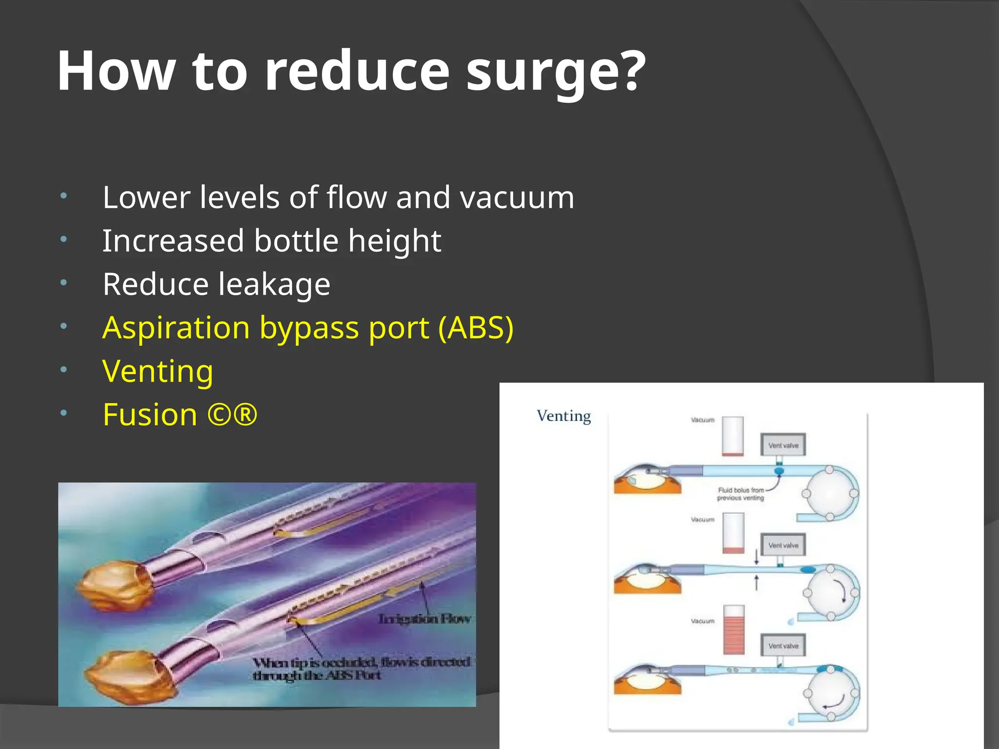 phacodynamics basics what you need to know | PPTX