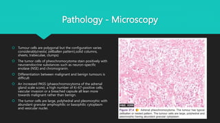 Phaeochromocytoma.pptx