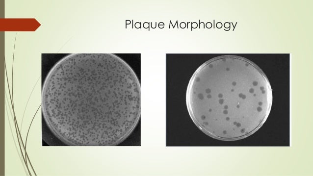 Bacterio Phage therapy