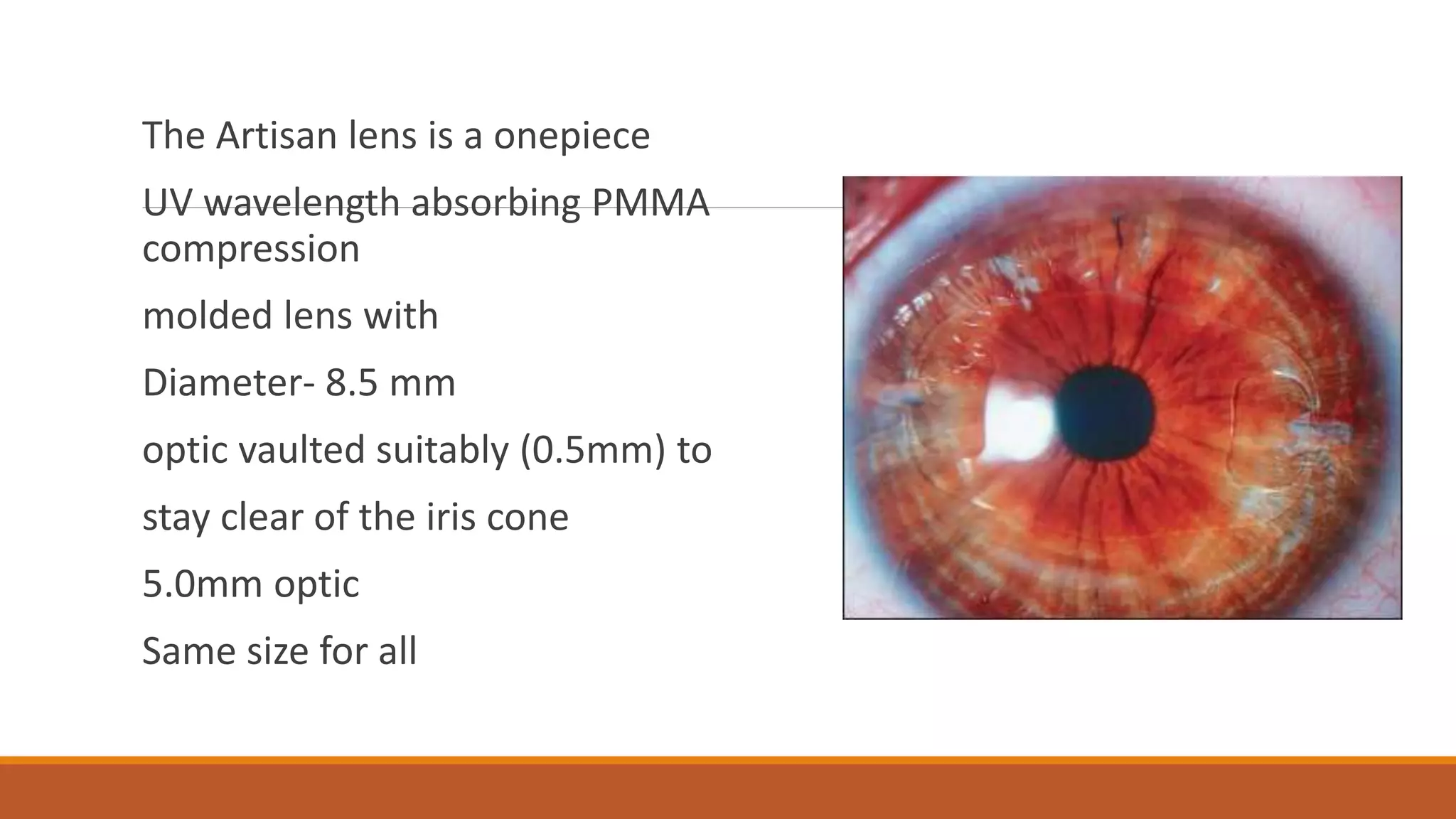 Phakic intraocular lens | PPTX