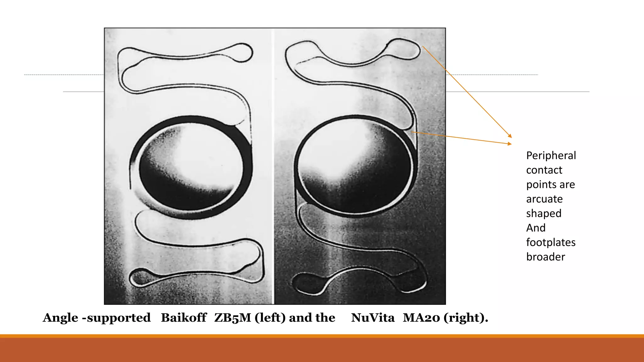 Phakic iol ppt | PPTX
