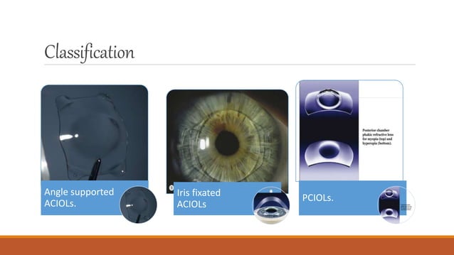Phakic iol ppt | PPTX