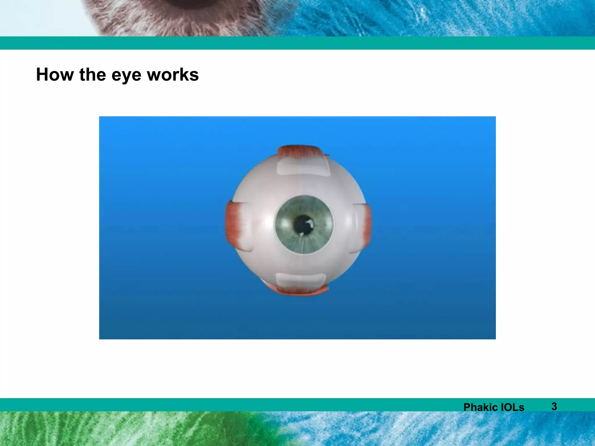 Phakic Intraocular implants in 2017 | ODP