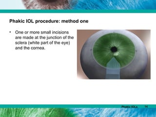 Phakic Intraocular implants in 2017 | ODP