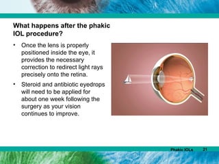 Phakic Intraocular implants in 2017 | PPT