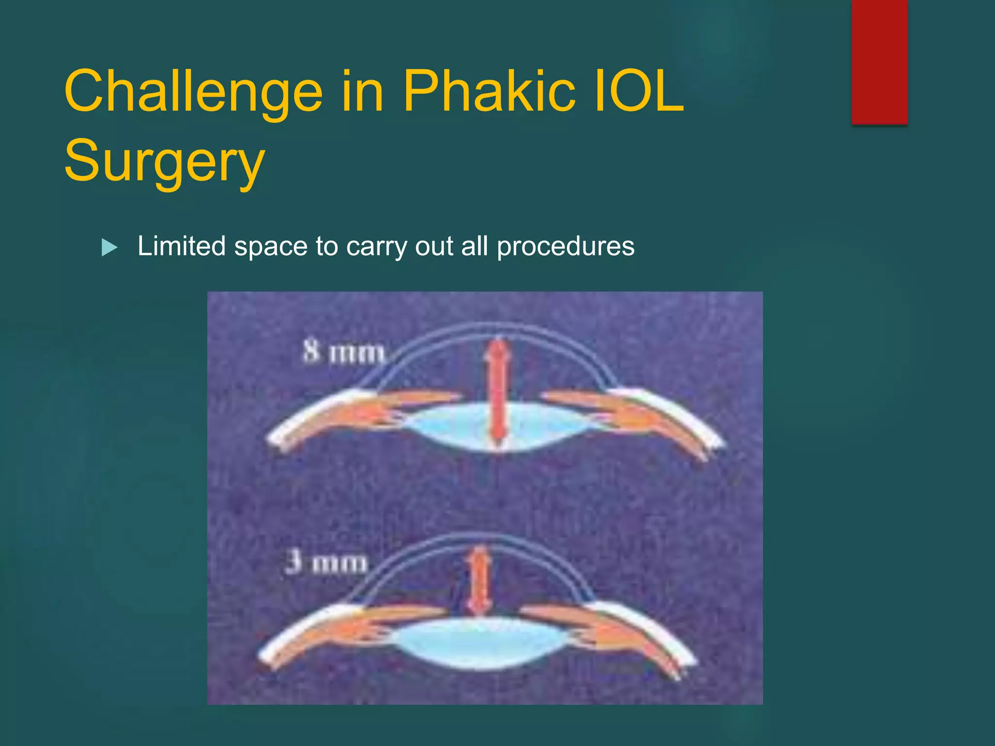 Phakic Intraocular lens | PPTX