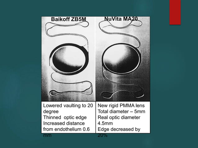 Phakic Intraocular lens | PPTX | Eye and Vision Conditions | Diseases ...