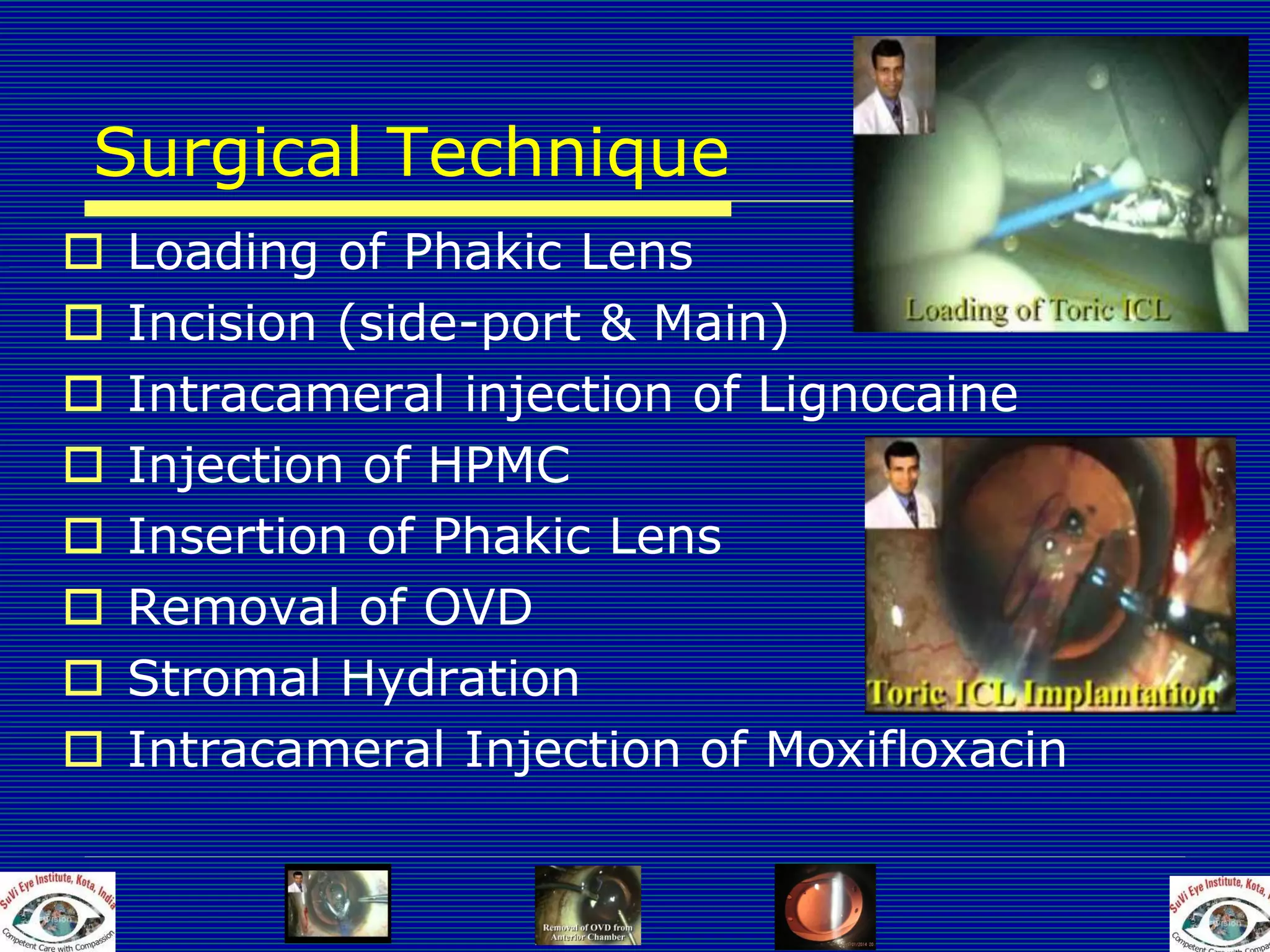 Phakic lens implantation, technique, complications & management by dr ...