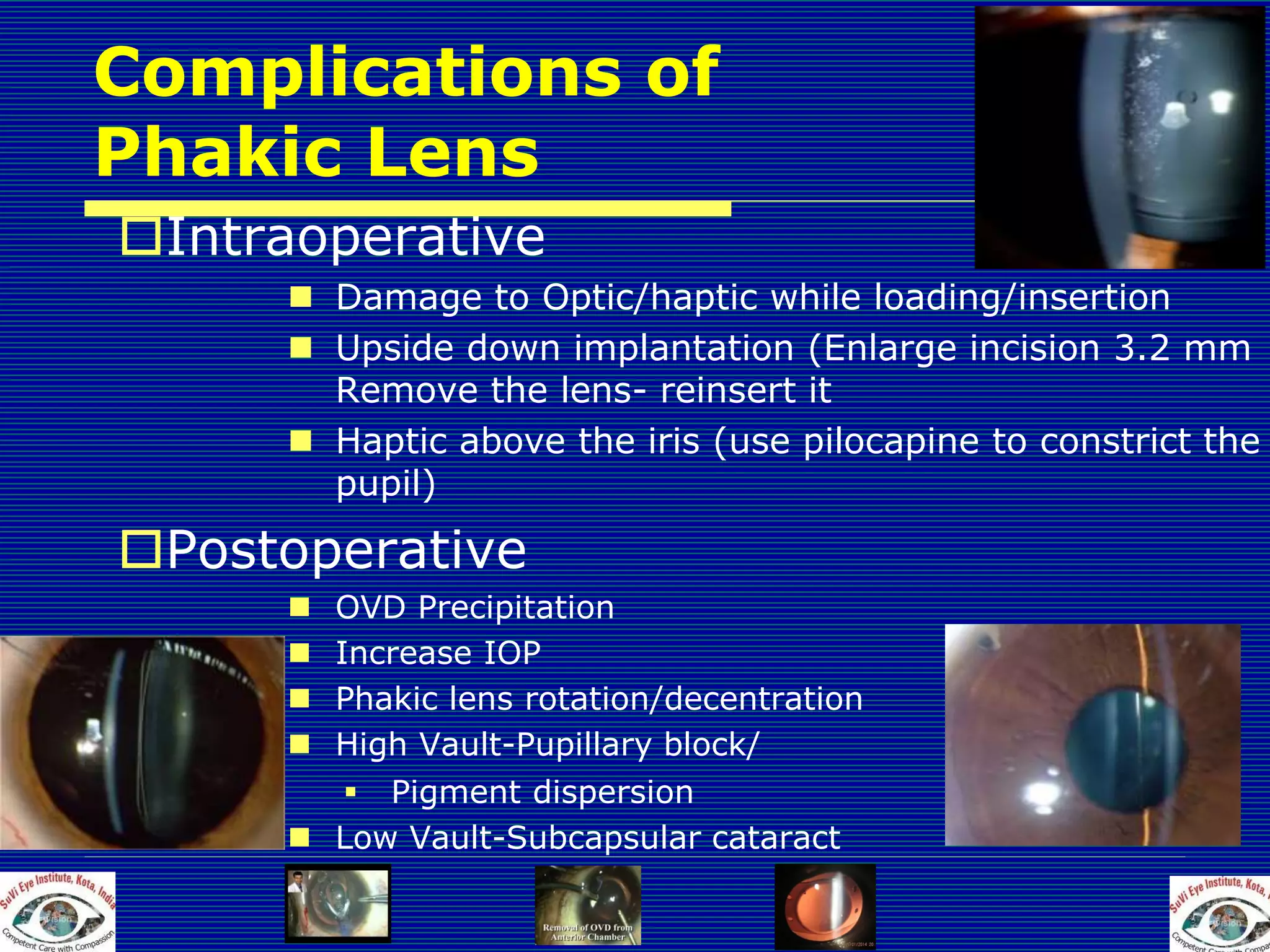 Phakic lens implantation, technique, complications & management by dr ...