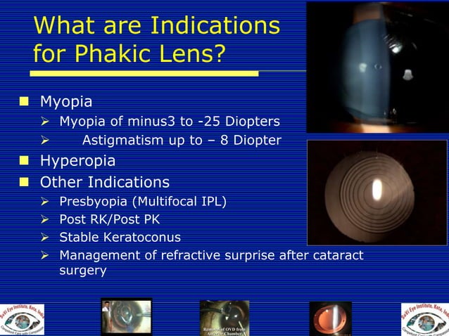Phakic lens implantation, technique, complications & management by dr ...