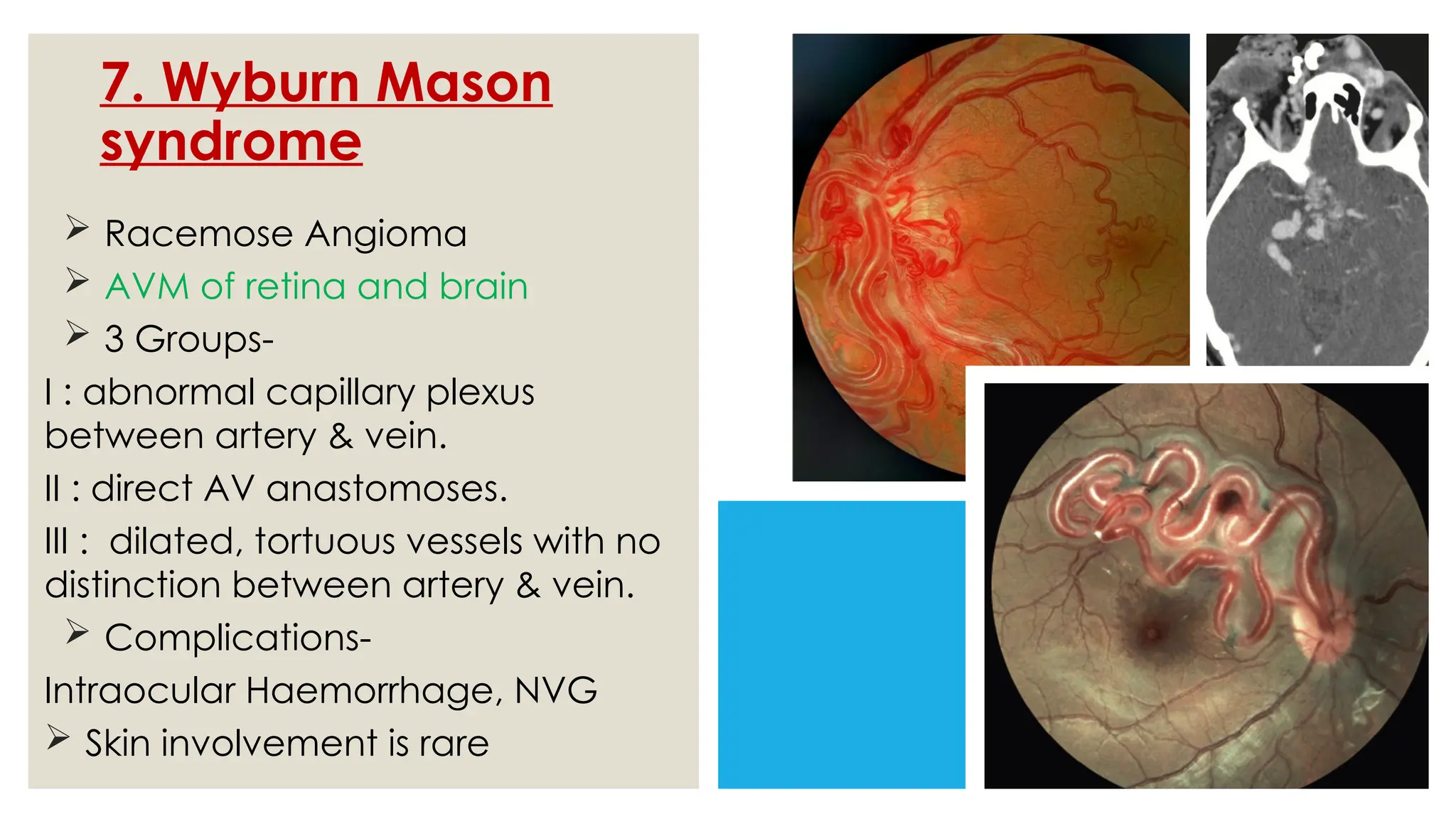 Phakomatoses or Neurocutaneous syndromes.pptx