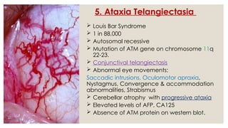 Phakomatoses or Neurocutaneous syndromes.pptx