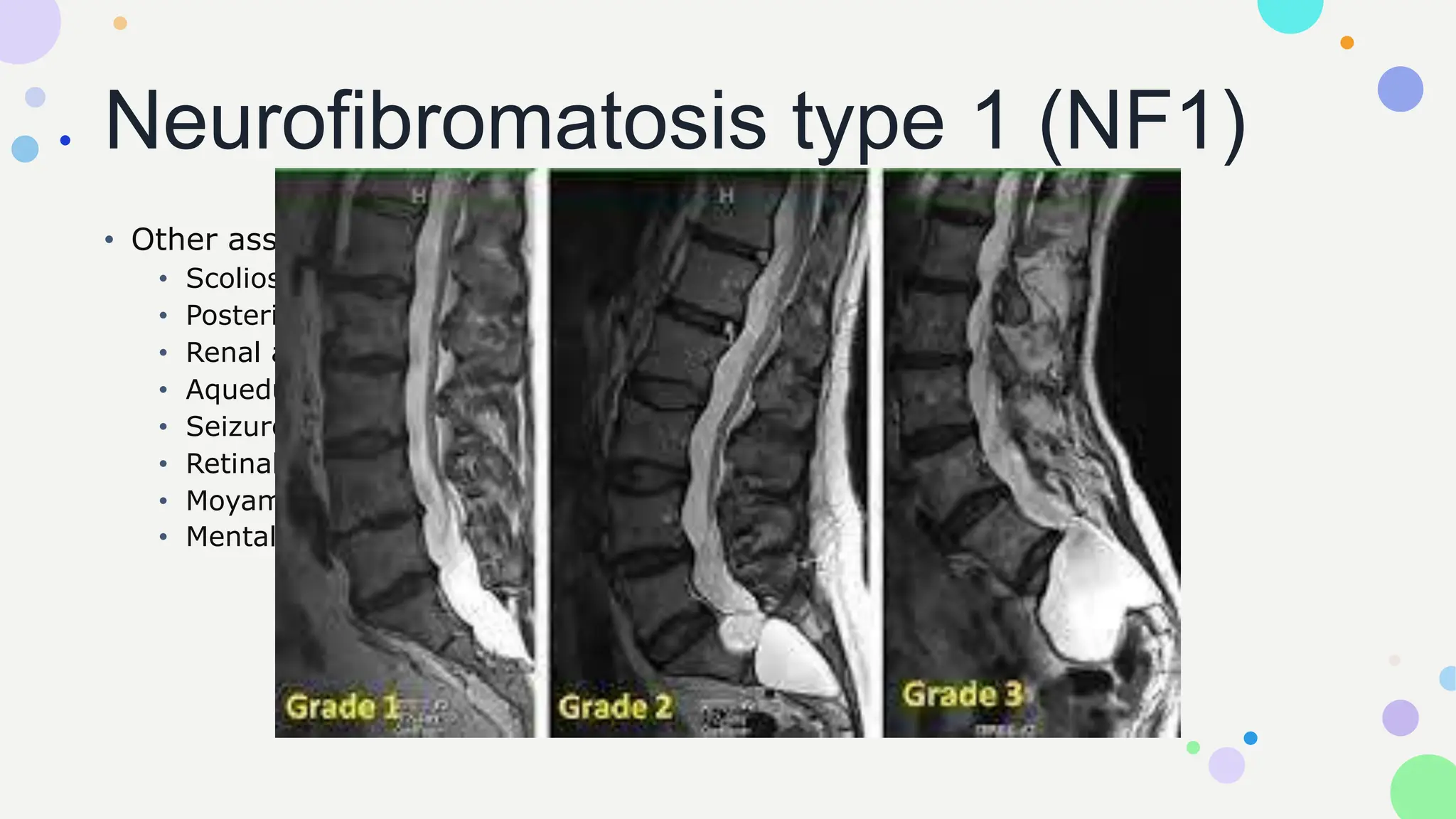 Phakomatoses + Congenital Metabolic disorders.pptx