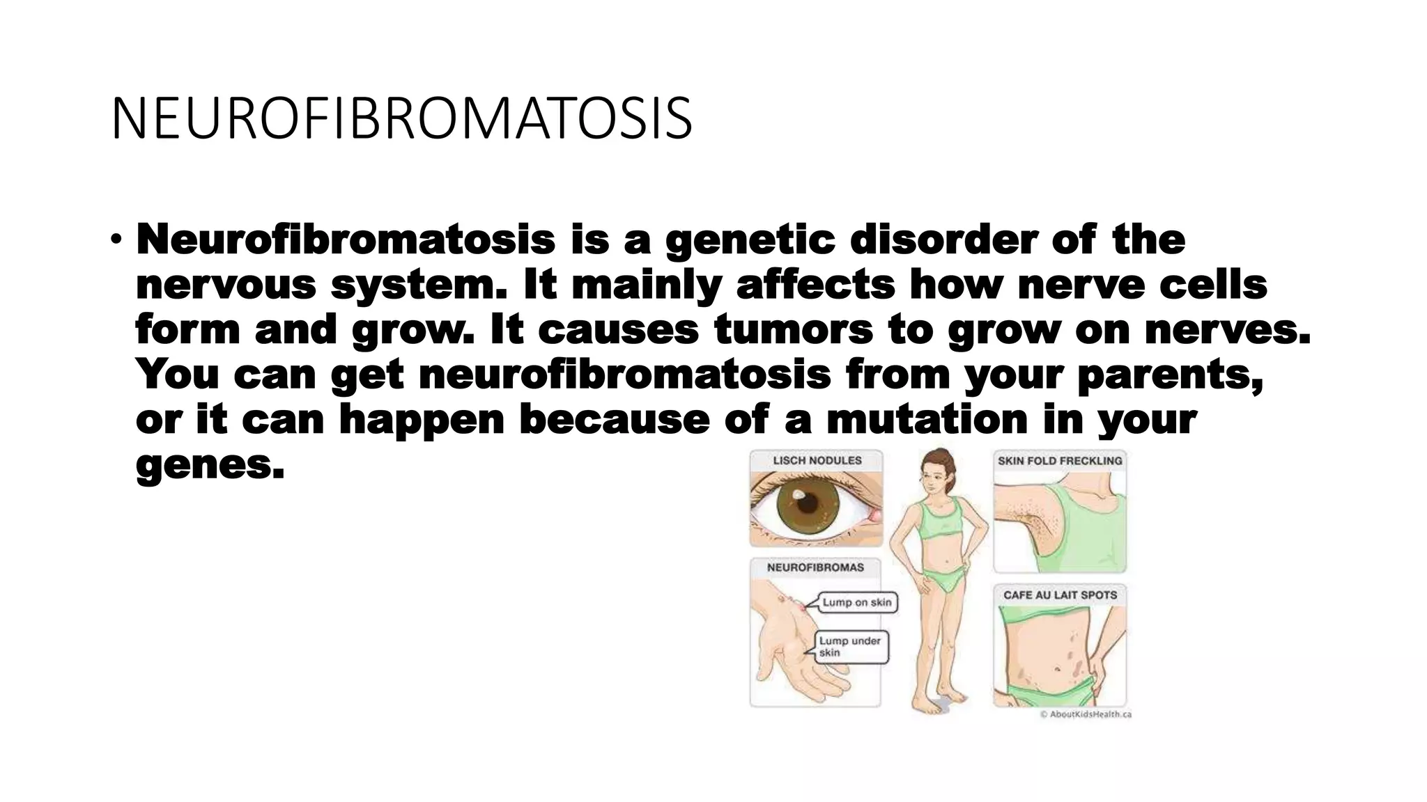 Phakomatosis | PPT