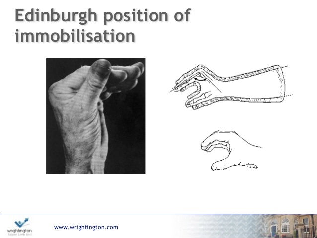 Hand Fractures and Dislocations