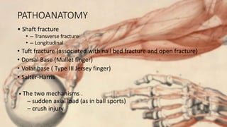 Phalangeal fractures of hand | PPTX