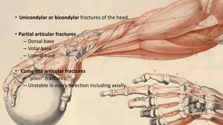Phalangeal fractures of hand | PPTX