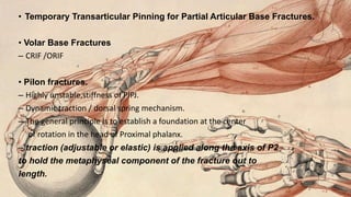 Phalangeal fractures of hand | PPTX