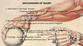 Phalangeal fractures of hand | PPTX
