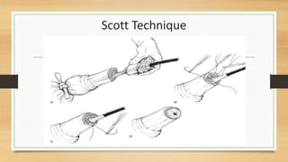 Phallectomy | PPTX | Surgery | Medical Health