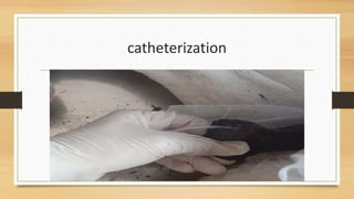 Phallectomy | PPTX | Surgery | Medical Health