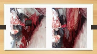 Phallectomy | PPTX | Surgery | Medical Health