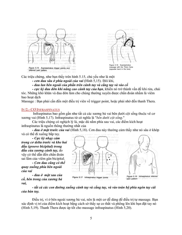 Phan c Trigger VHN | PDF