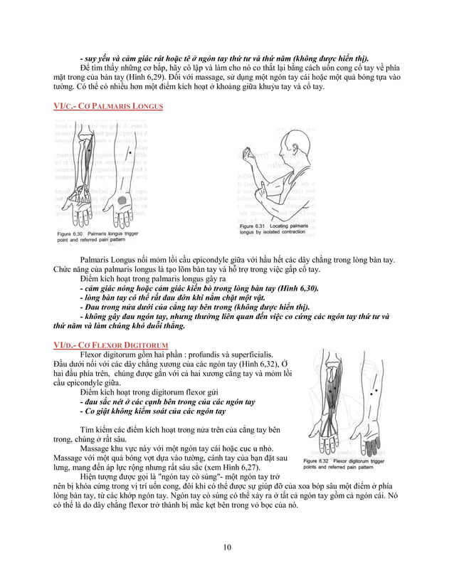 Phan d Trigger VHN | PDF
