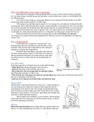 Phan d Trigger VHN | PDF