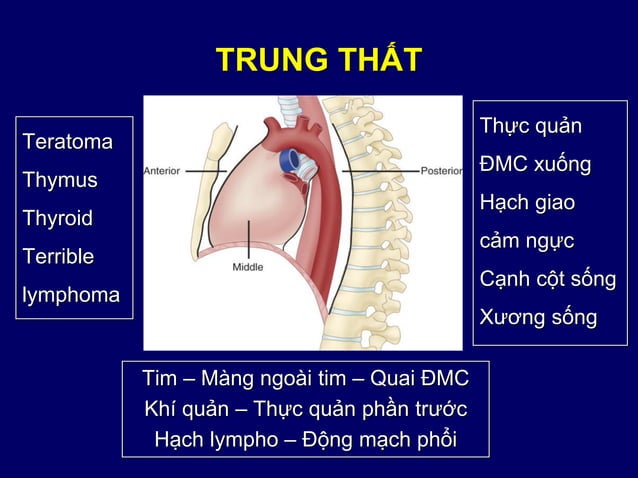 PHÂN TÍCH HÌNH ẢNH X QUANG LỒNG NGỰC | PDF
