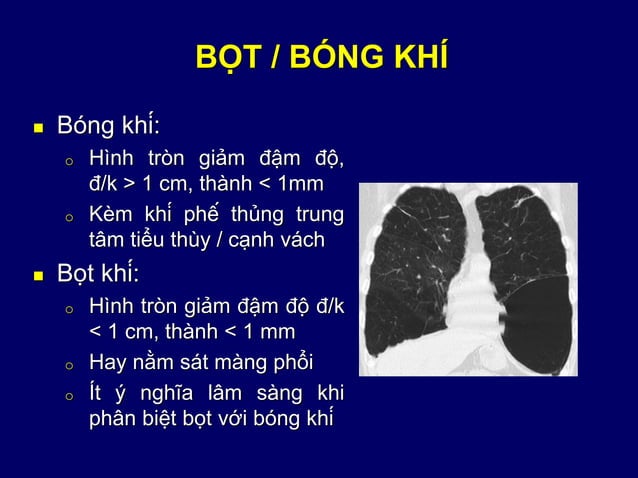 PHÂN TÍCH HÌNH ẢNH X QUANG LỒNG NGỰC | PDF