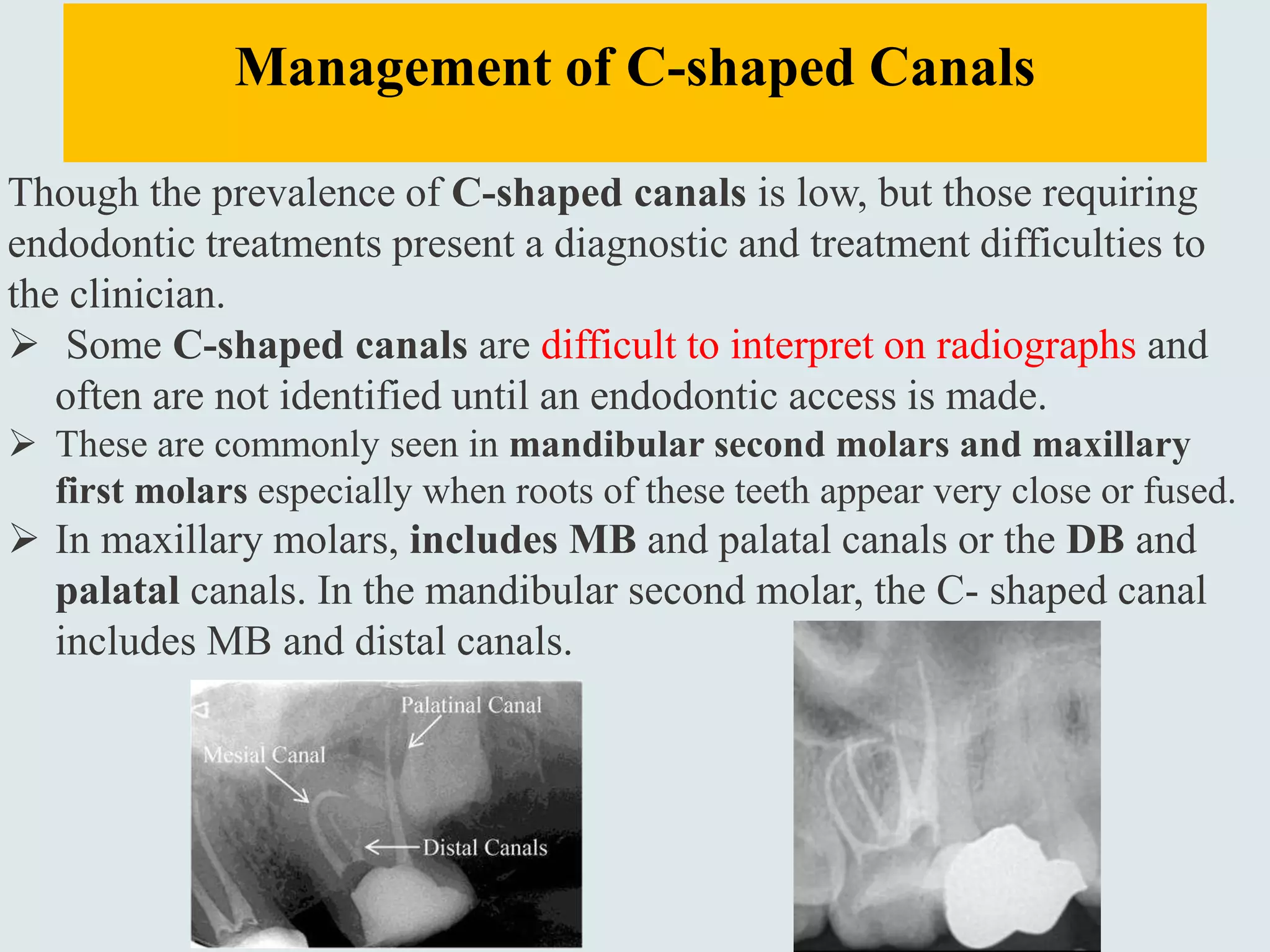 phantomic endodentic.ppt