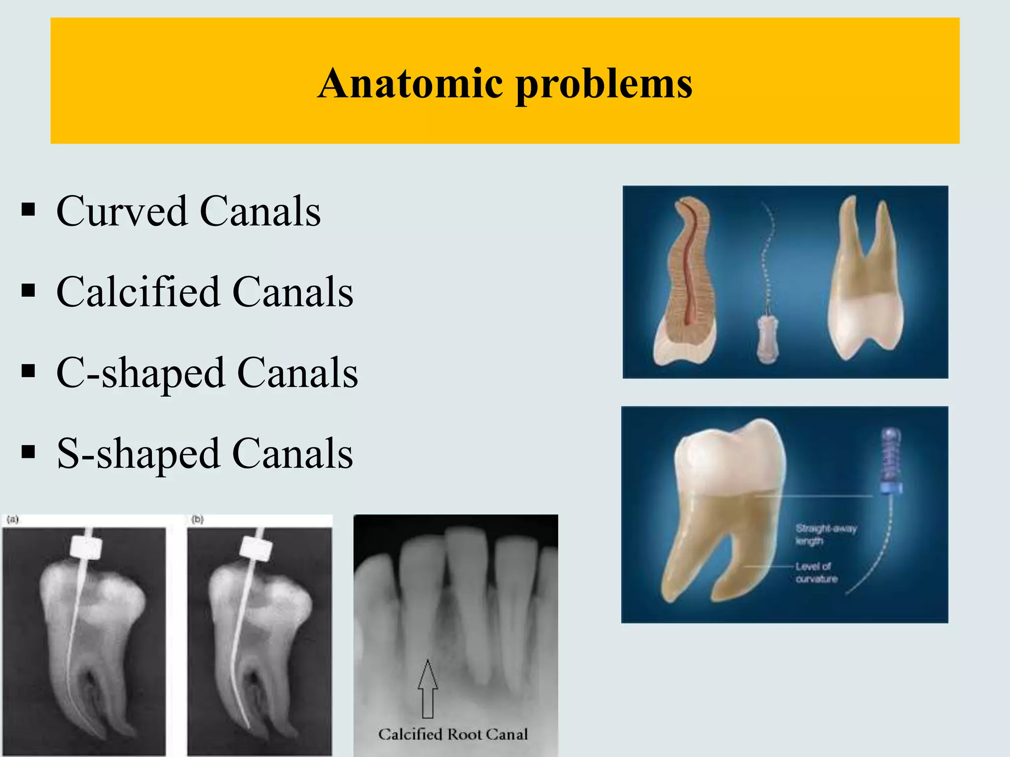 phantomic endodentic.ppt