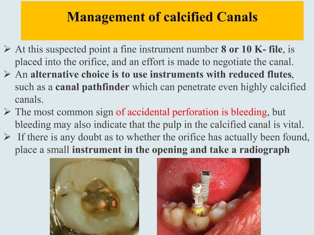 phantomic endodentic.ppt | Dental Health | Diseases and Conditions