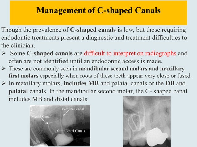 phantomic endodentic.ppt | Dental Health | Diseases and Conditions