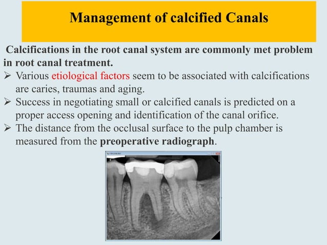 phantomic endodentic.ppt | Dental Health | Diseases and Conditions