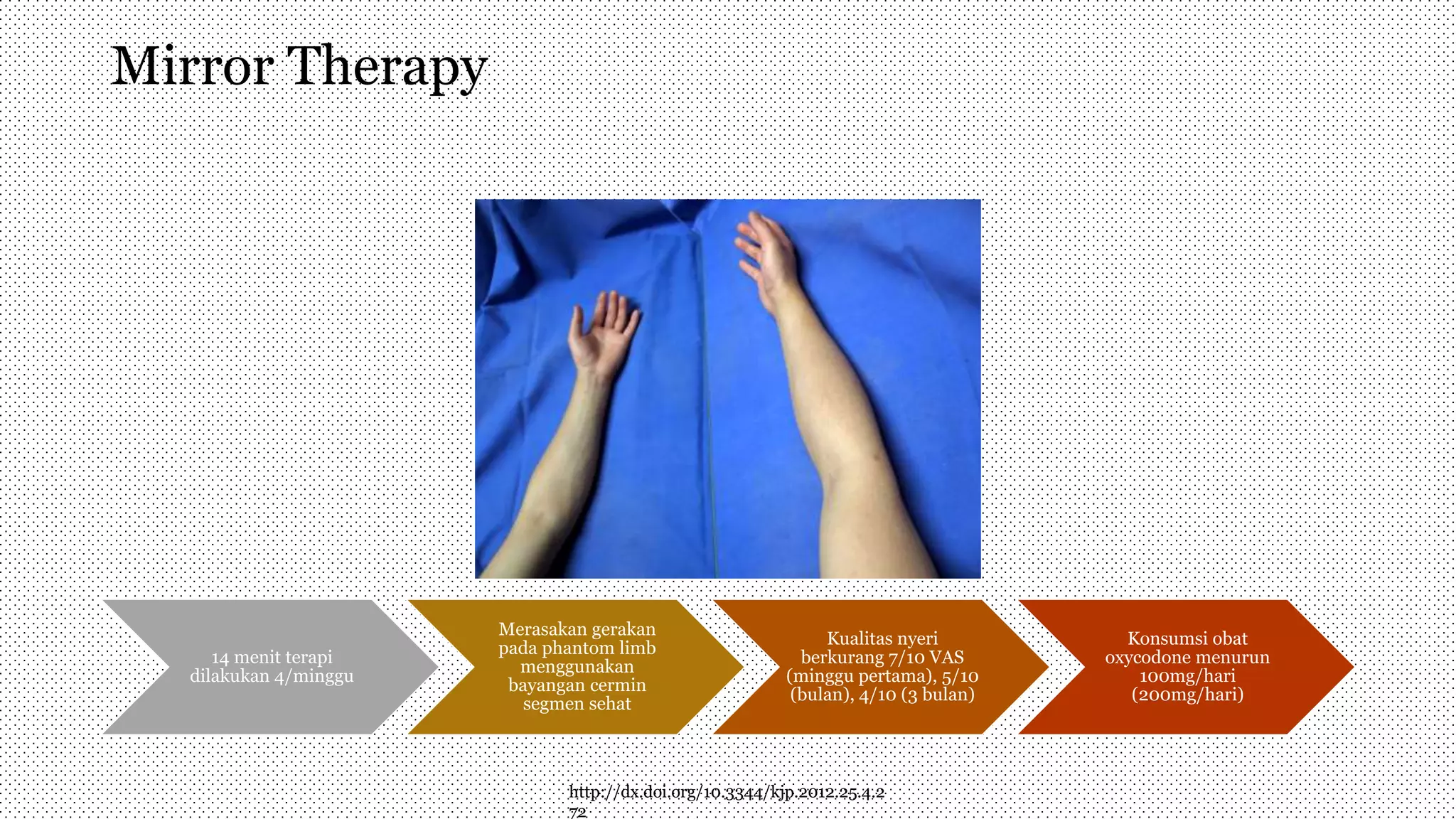 Phantom Limb Pain.pptx