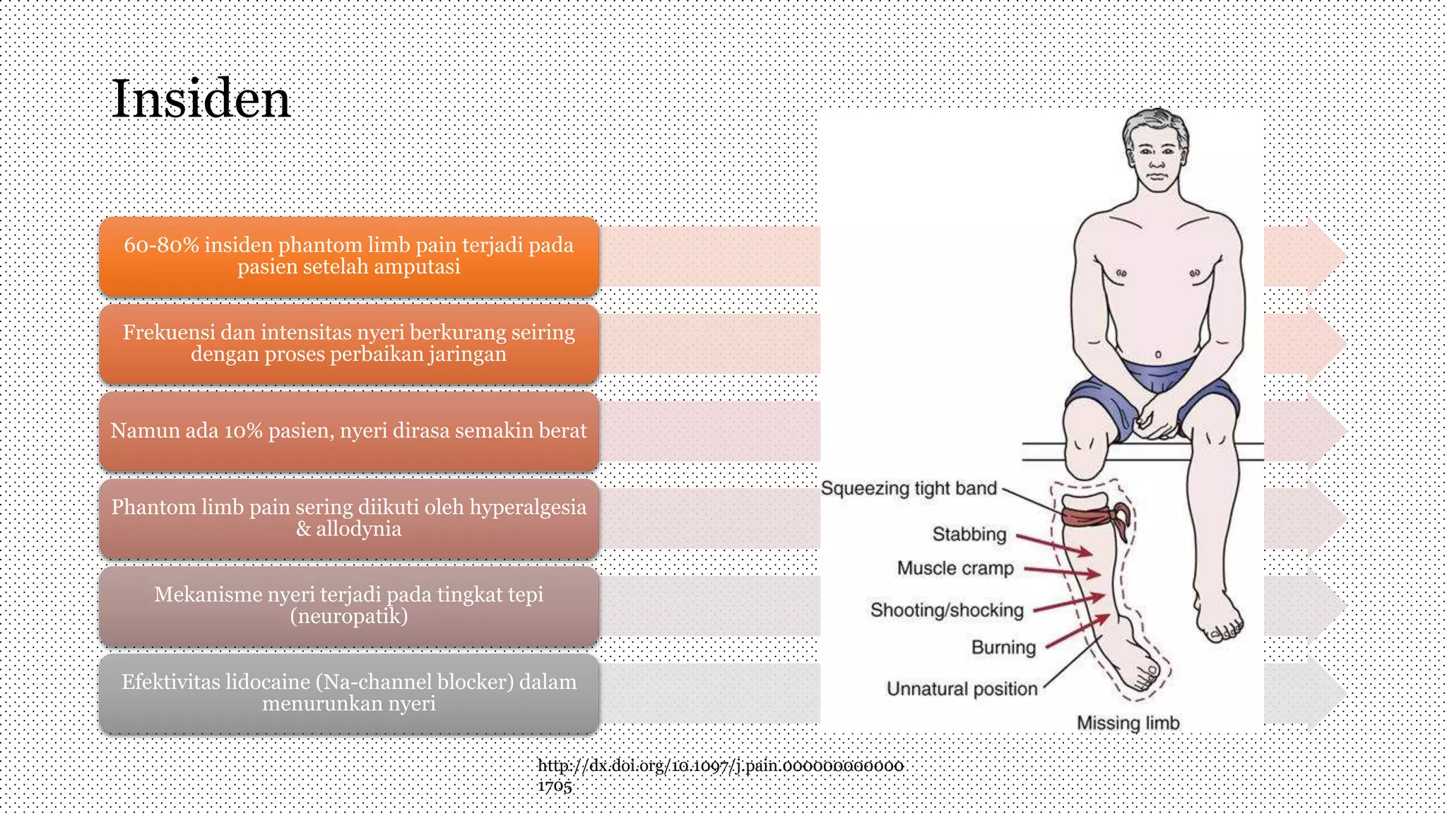 Phantom Limb Pain.pptx